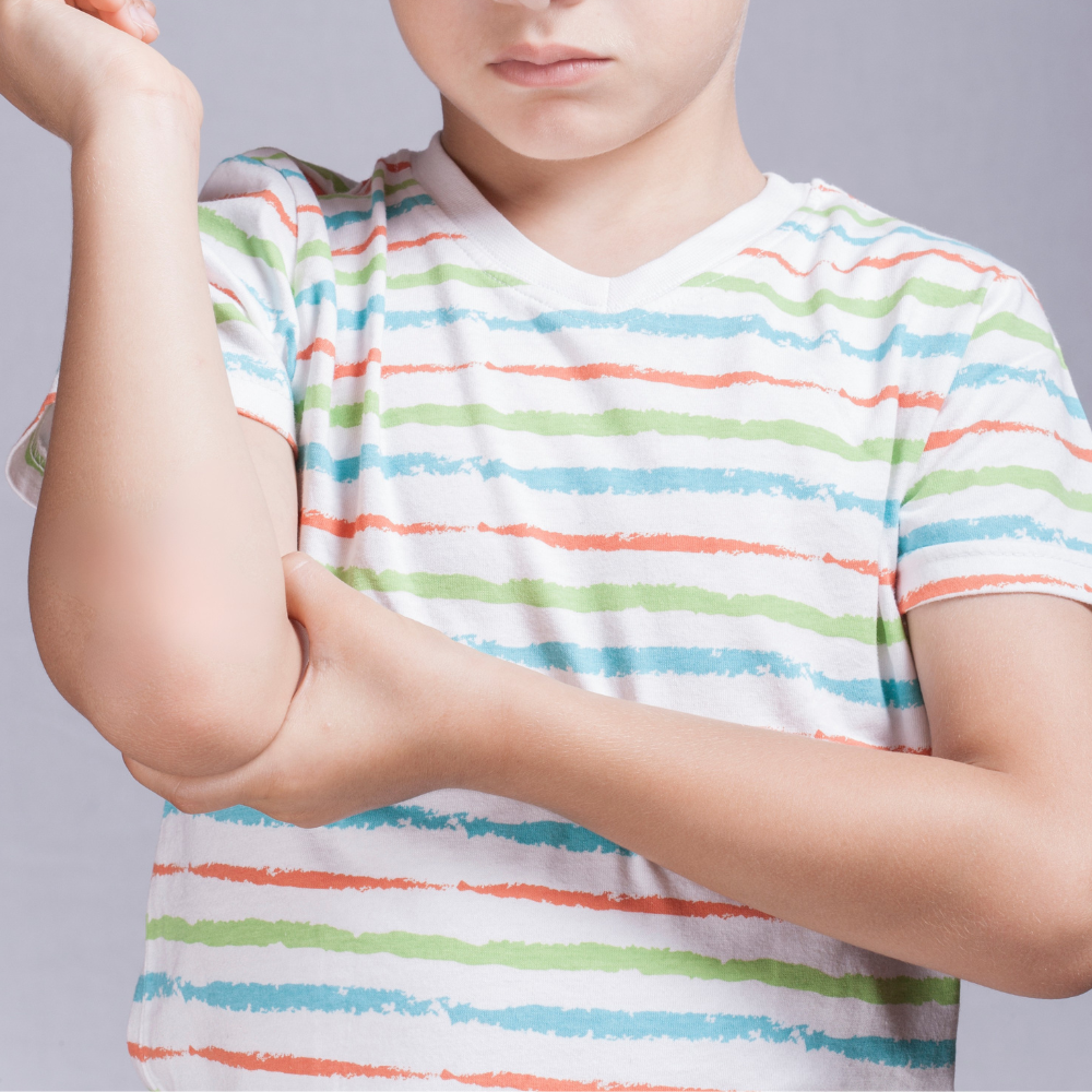 Codo de niñera en niños: qué es, señales y consejos que todos los ...