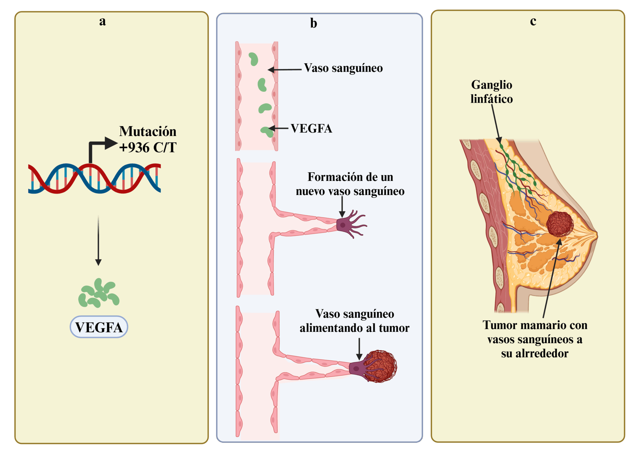 El papel del gen VEGFA en mujeres mexicanas con cáncer de mama – Con ...